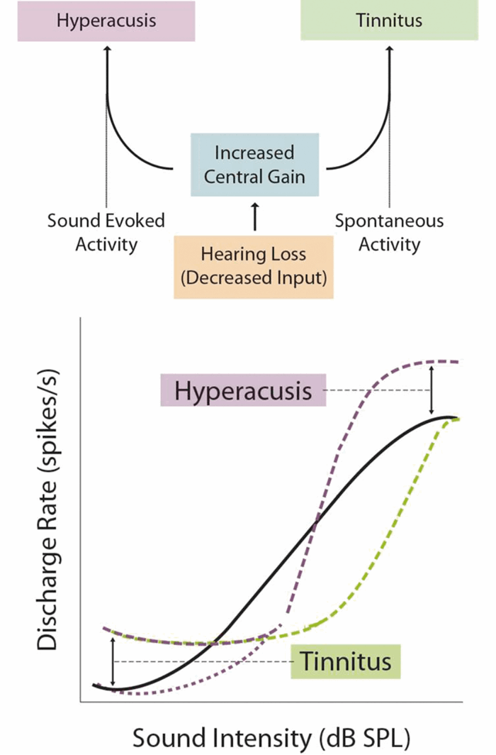 Physiological mechanisms of hyperacusis: an update | ENT & Audiology News