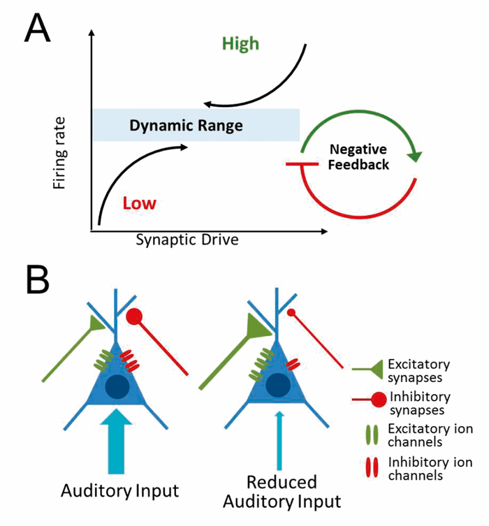 Physiological mechanisms of hyperacusis: an update | ENT & Audiology News