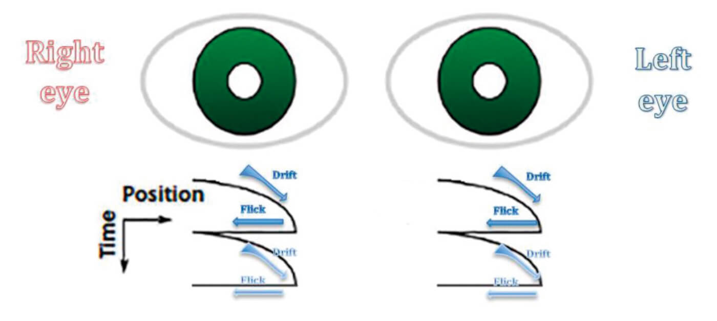 Developments in diagnostic approaches for acutely dizzy patients | ENT ...