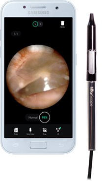 Digital otoscopy with AI diagnostic support: making diagnosis of ear ...