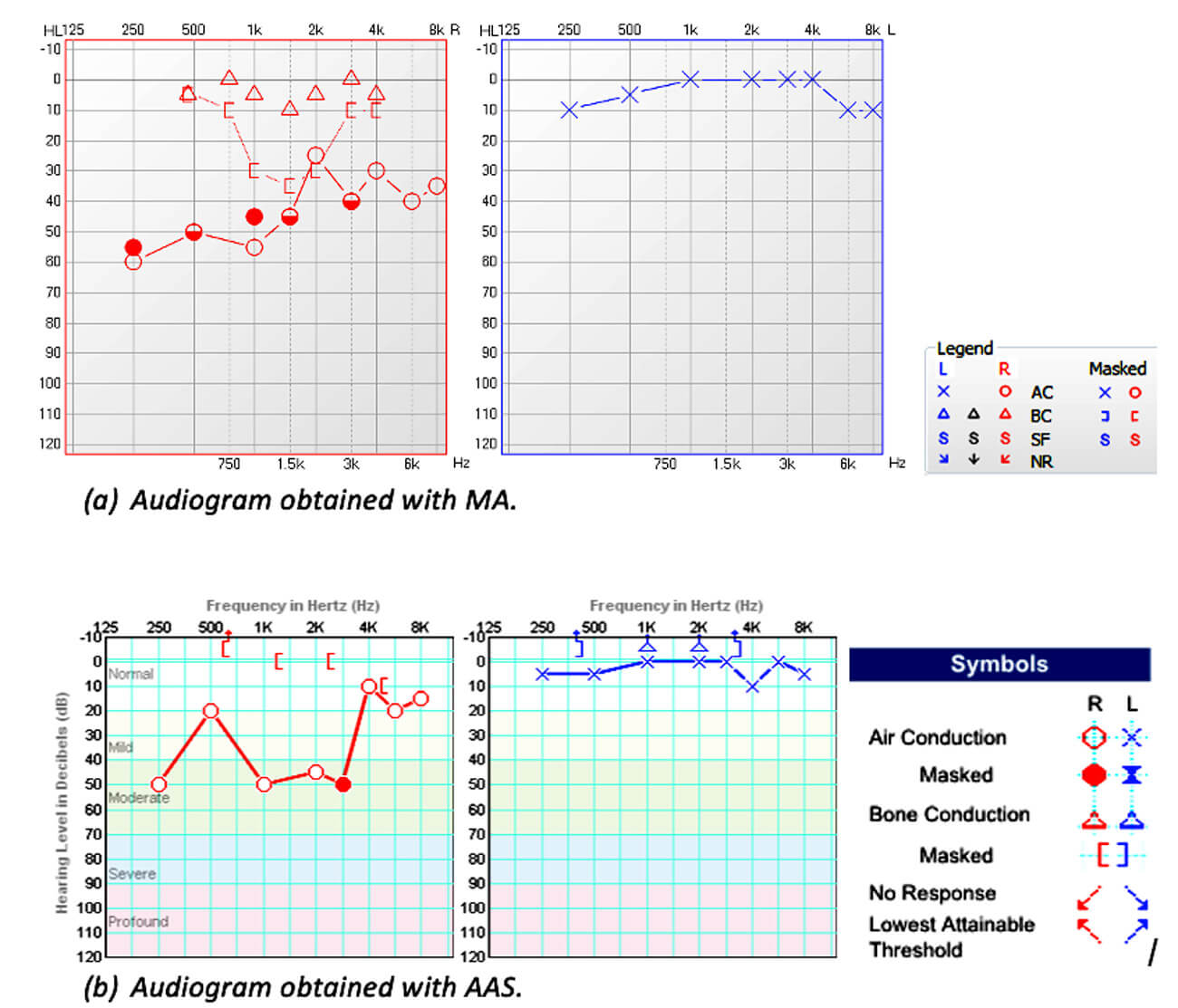 Use of automated audiometry for faster patient access to audiology ...
