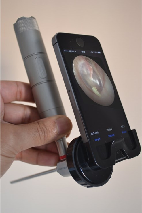 Developing an Innovation for ENT – from Idea to Market: how ‘e-i’ did ...