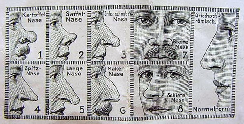 The golden nose – reshaping the nose 100 years ago | ENT & Audiology News