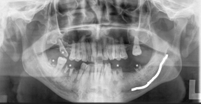 Radiology of referred otalgia | ENT & Audiology News