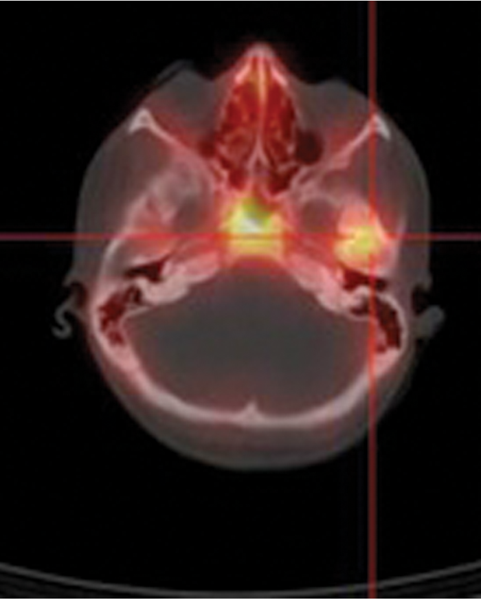 Nuclear heads – and necks | ENT & Audiology News