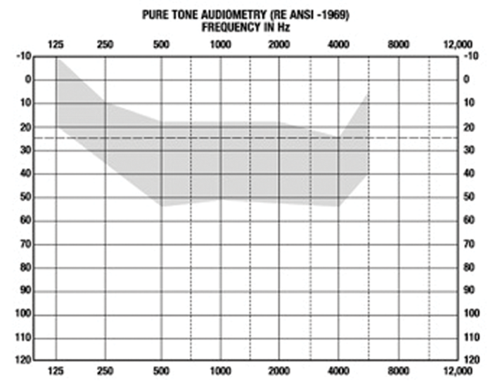 The changing role of audiology | ENT & Audiology News
