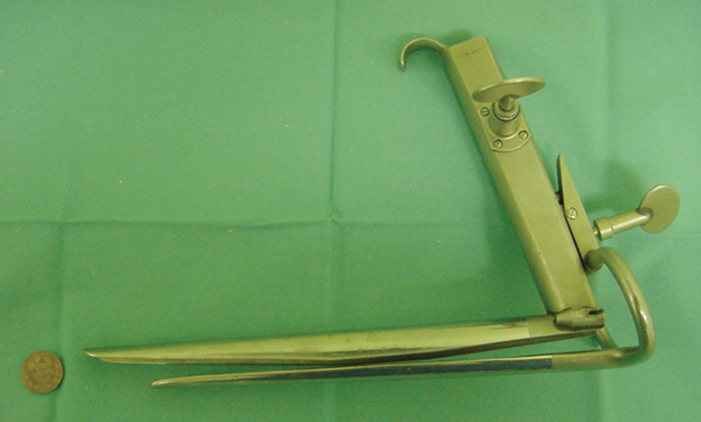 CO2 Laser Dohlmans: Does It Still Have A Role In Pharyngeal Pouch ...