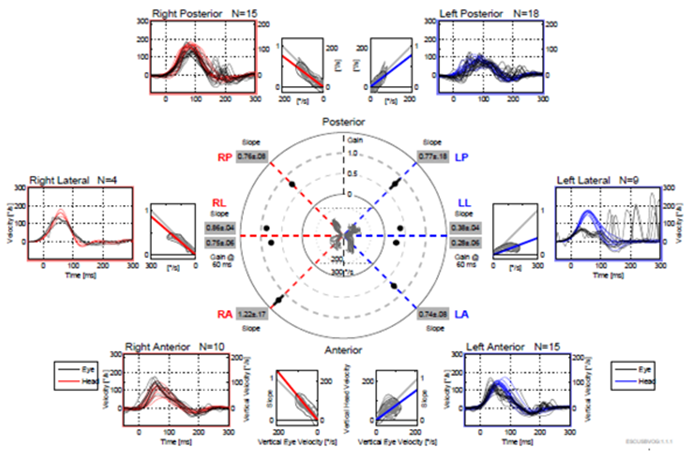 Advances in vestibular function testing | ENT & Audiology News