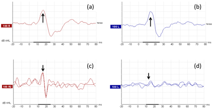 Advances in vestibular function testing | ENT & Audiology News