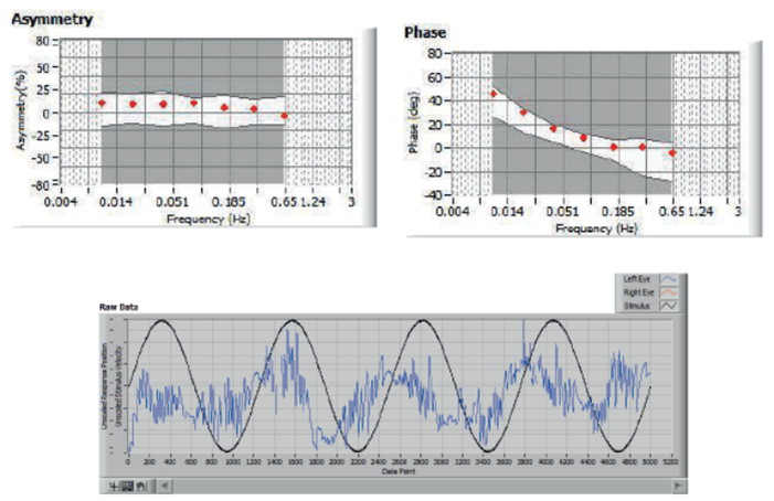 Rotational chair testing: “To rotate, or not to rotate, that is the ...