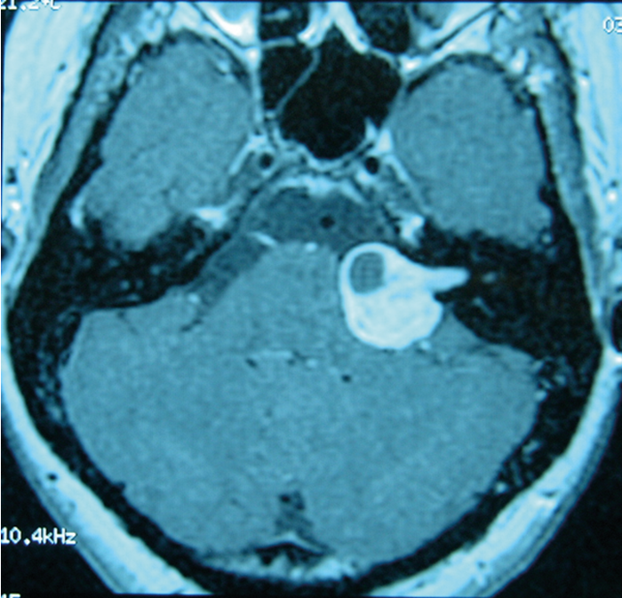 A practical approach to tinnitus | ENT & Audiology News