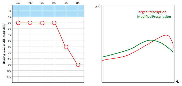 Audiological approach to treatment of blast-induced tinnitus | ENT ...