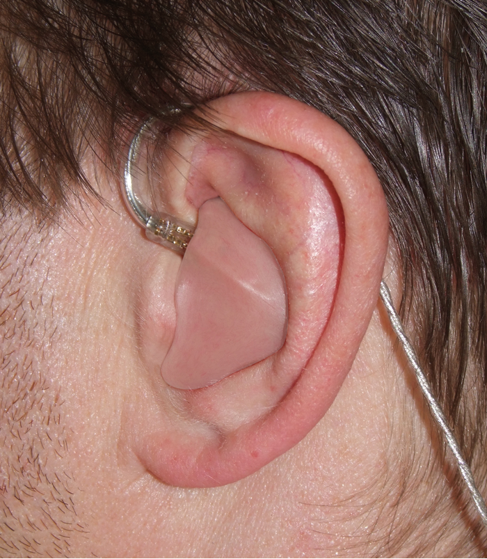 IEM – no noise is good noise! | ENT & Audiology News