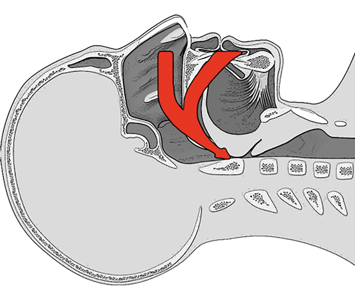 Should human beings sleep in the prone position? | ENT & Audiology News