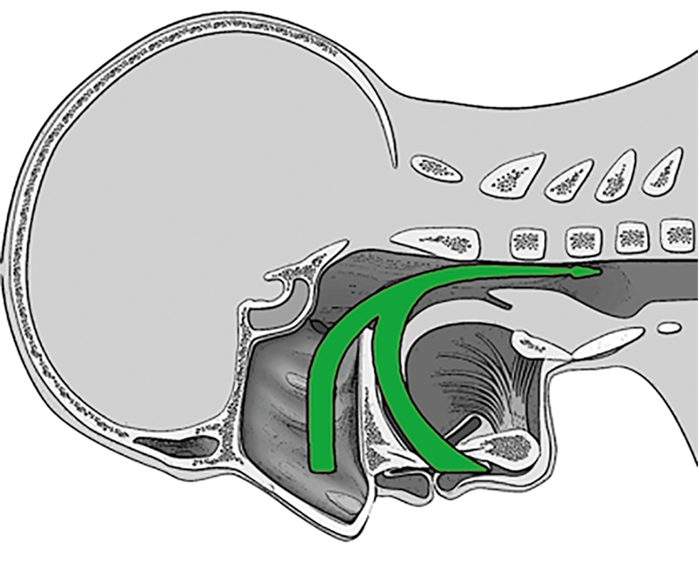 Should human beings sleep in the prone position? | ENT & Audiology News