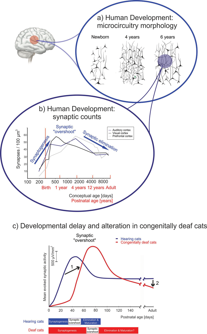 Plasticity with cochlear implants: individual factors in the outcomes ...