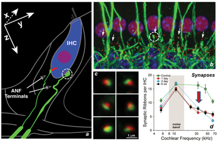 What’s hidden in hidden hearing loss? | ENT & Audiology News